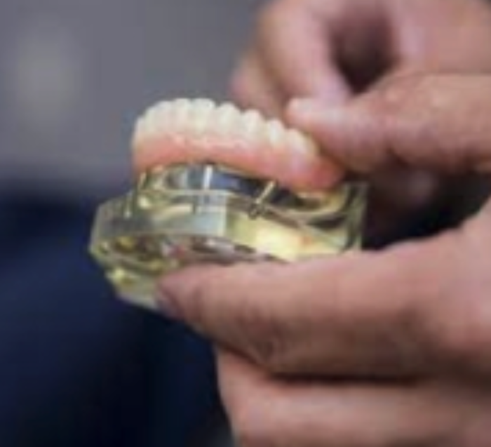 Dental Implant Options for Denture Wearers - Dental Implants GPS