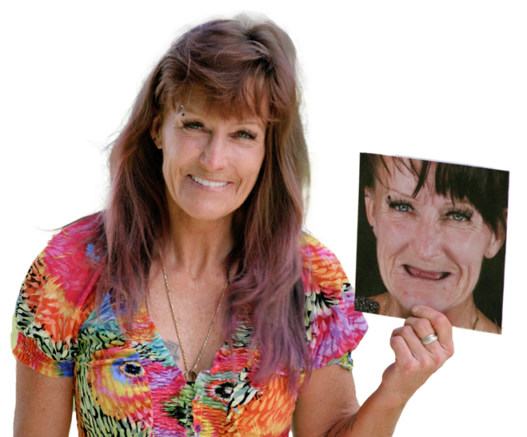 Dental Implant Options for Denture Wearers - Dental Implants GPS